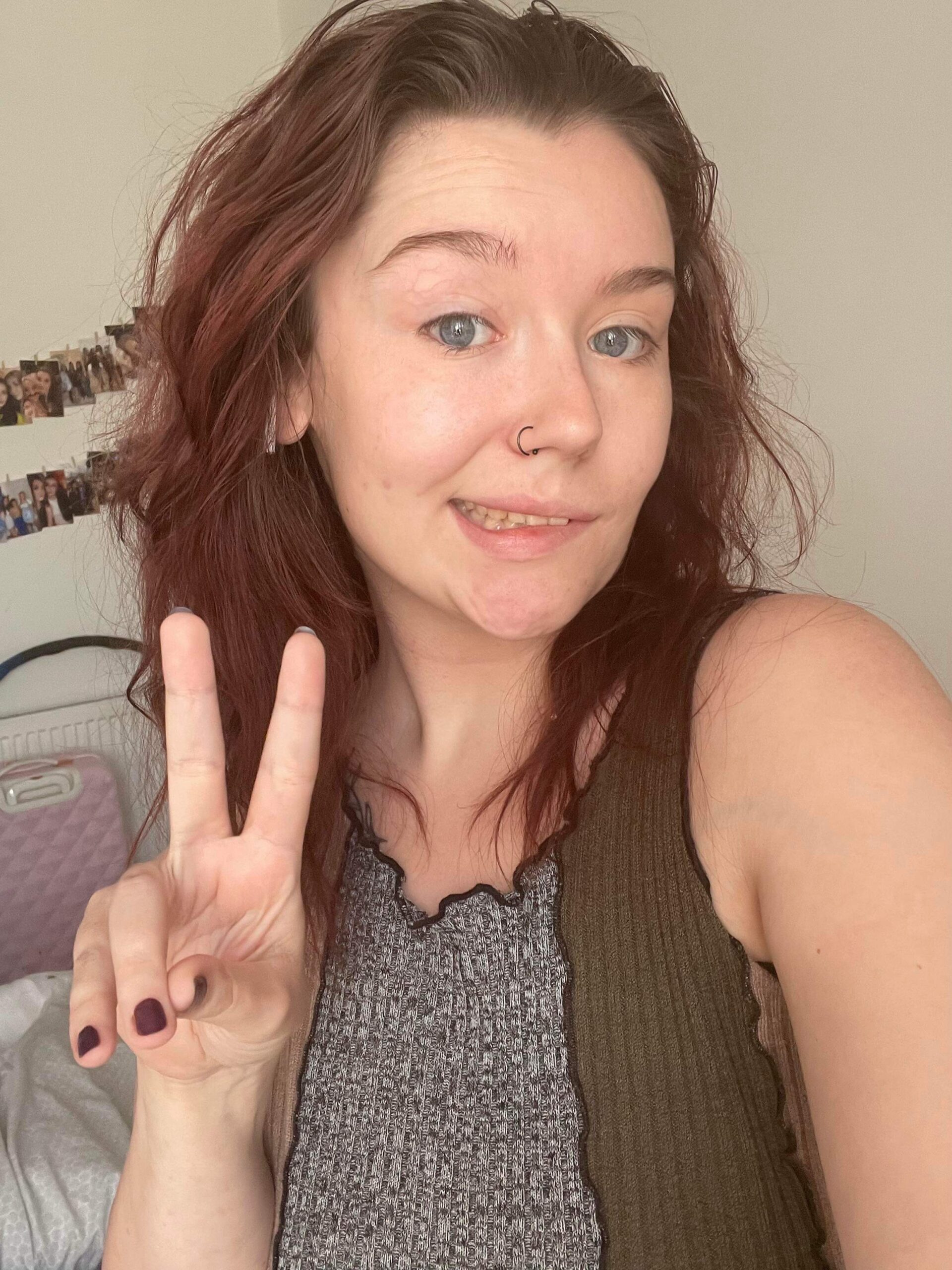 Molly's Story - Facial Palsy UK